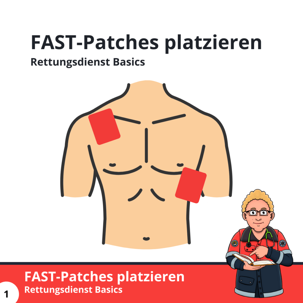 FAST-Patches bei der Defibrillation im Rettungsdienst